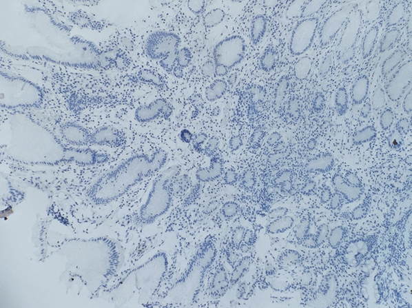Biópsias Gástricas | Sociedade Brasileira de Patologia