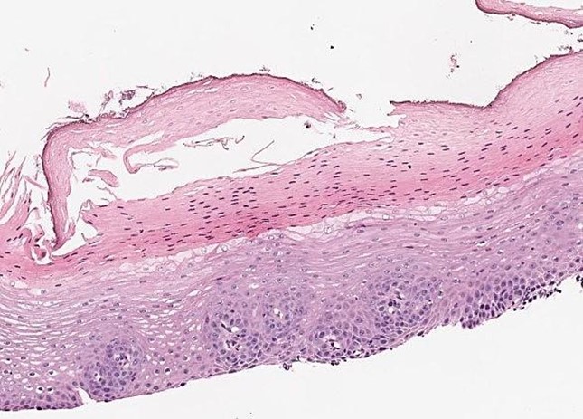 Esôfago | Sociedade Brasileira de Patologia